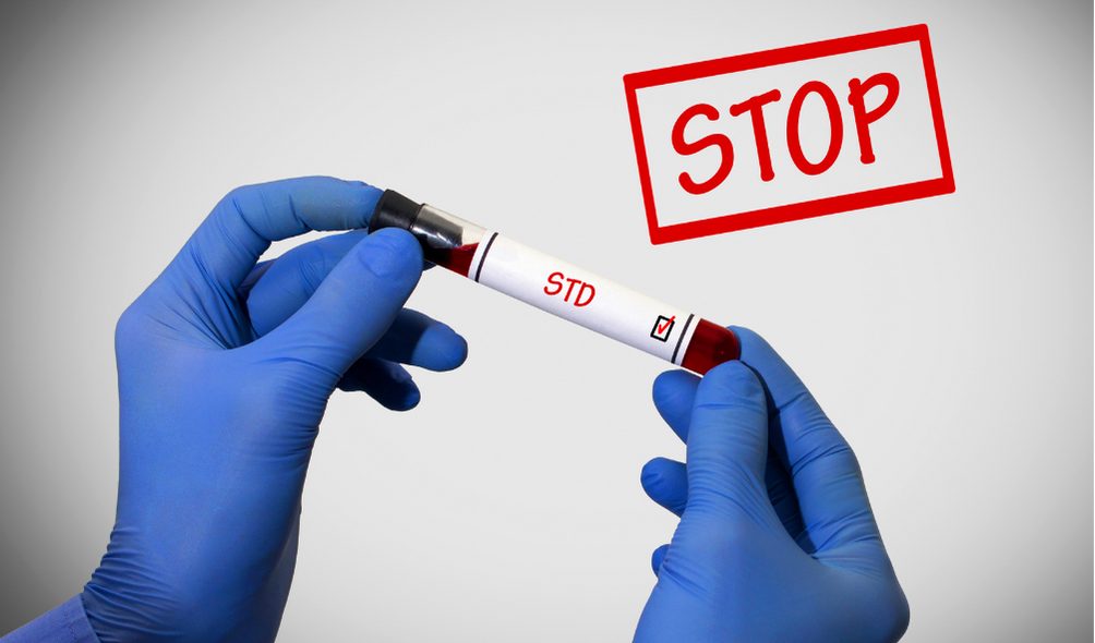 What is Chlamydia STD and Why Should You Care - Bare Foots World